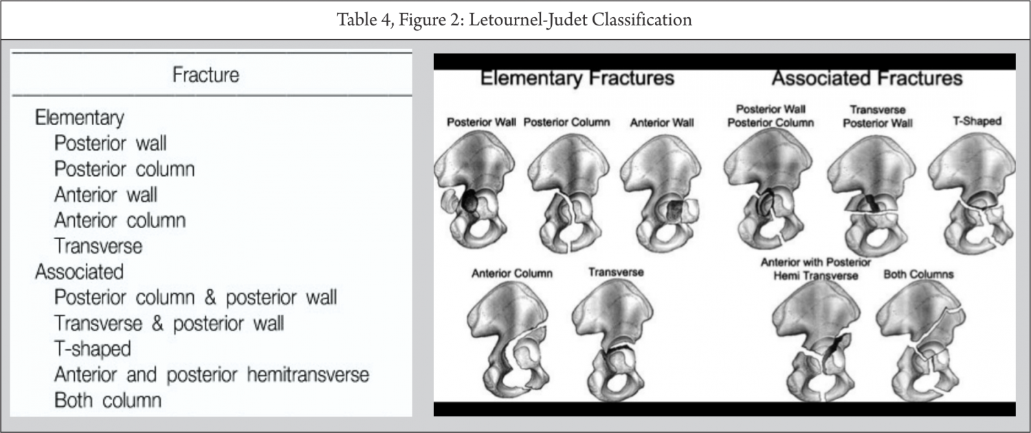Classification of Pelvis and Aetabulum Injuries – Trauma International